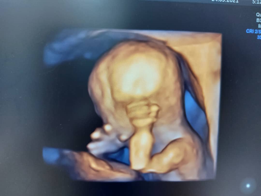 3D And 4D Scans DR EVELYN PANG