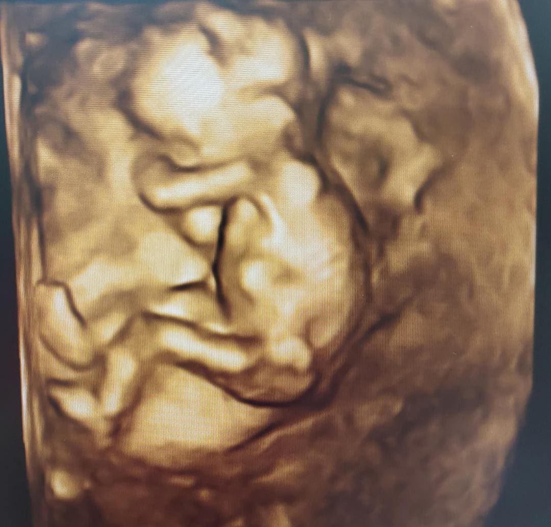 3D And 4D Scans DR EVELYN PANG